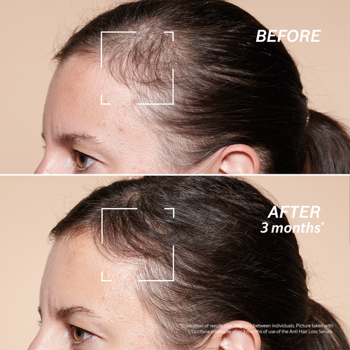 Hair loss store
